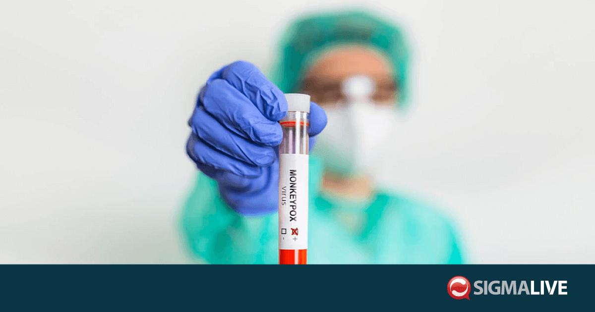 Υπ. Υγείας: Διαχειρίσιμη η κατάσταση με την ευλογιά πιθήκων - Sigmalive