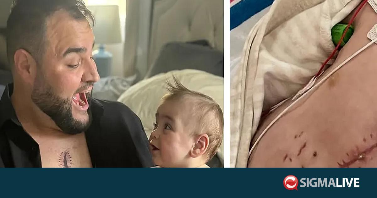 Έκανε τατουάζ την ουλή του γιου του - «Δεν θα είναι ποτέ μόνος» - Sigmalive