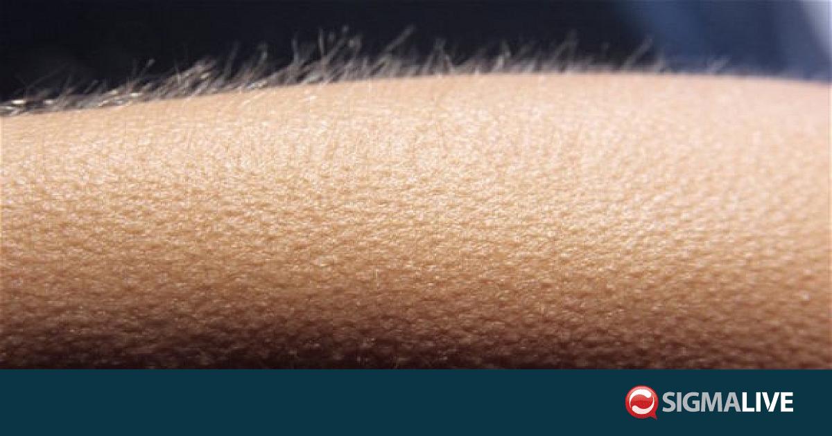 Γιατί μερικοί άνθρωποι νιώθουν ανατριχίλα ακούγοντας μουσική - Sigmalive