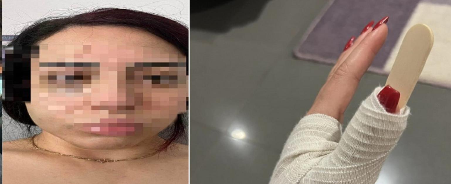 Ξυλοδαρμός Τ/κ: «Δεν θέλω να προκληθεί ένταση – Οι Αρχές επενέβησαν άμεσα» - Sigmalive