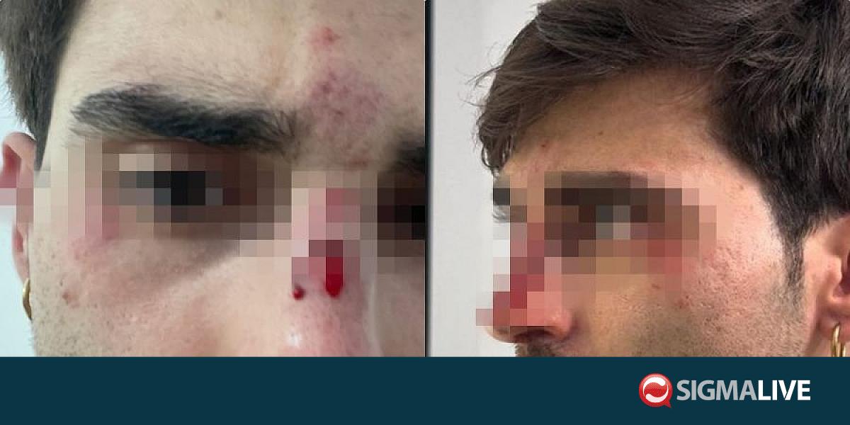 ACCEPT: Φτάνει να λέμε ότι οι ΛΟΑΤΚΙ προκαλούν,άρα κάτω τα χέρια από τα παιδιά - Sigmalive